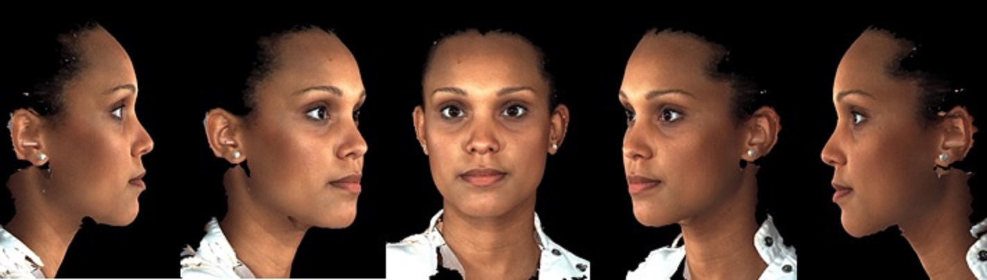 3D Photo - Medical & Dental Scanning - Cavendish Imaging Ltd
