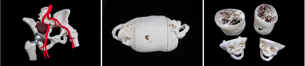 Our 3D Printed Models - Cavendish Imaging