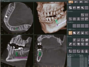 CBCT Training - Cavendish Imaging