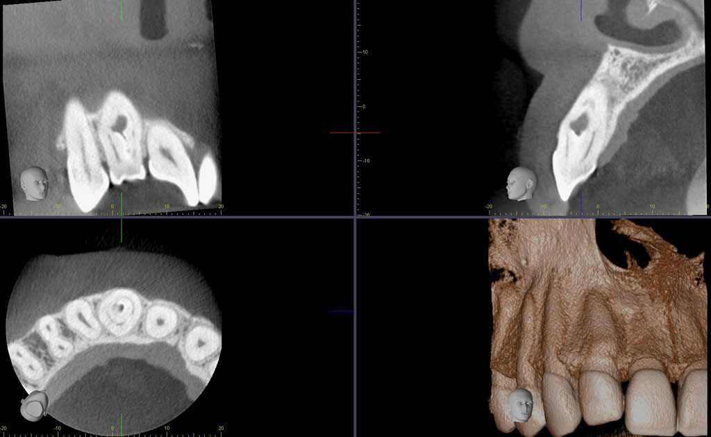 CBCT for Dentistry - Dental Scanning - Cavendish Imaging