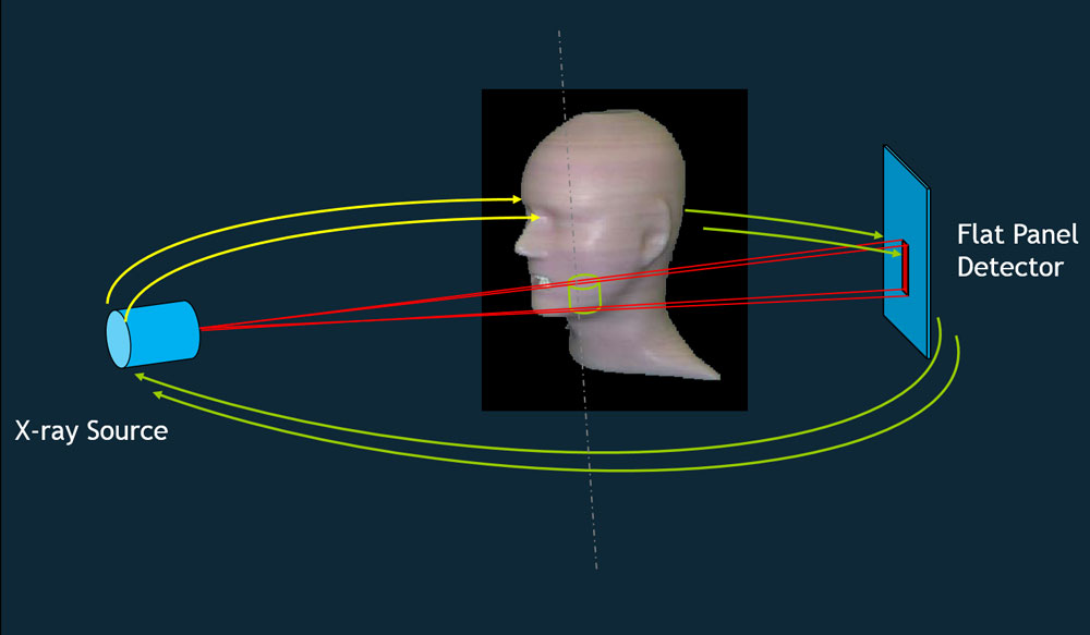 CBCT Medical Dental Scanning Cavendish Imaging Ltd CBCT Medical Dental Scanning Cavendish Imaging Ltd