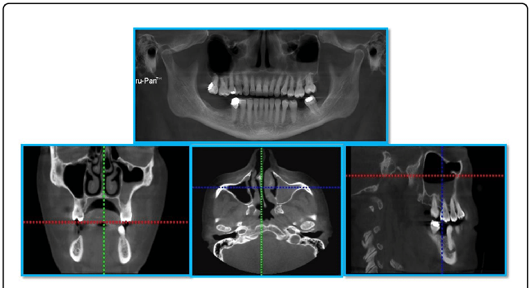 The Evolution of Dental Imaging: From Panoramics to CBCT Scans and ...