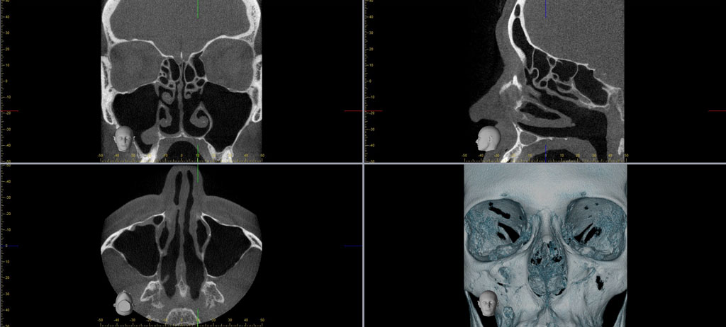 CBCT Training - Cavendish Imaging