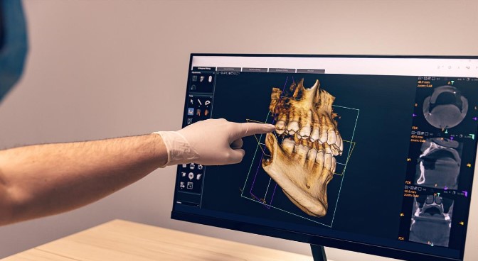 Key Aspects of a Dental CBCT Radiology Report: What You Need to Know ...
