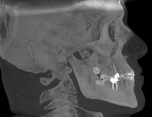 CBCT Scans in Oral and Maxillofacial Surgery: Advanced Applications for ...