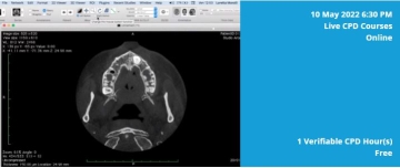 CBCT Training - Cavendish Imaging