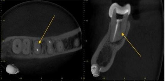 CBCT Training - Cavendish Imaging