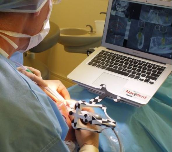 An introduction to dynamic guidance for precise and safe dental implant ...